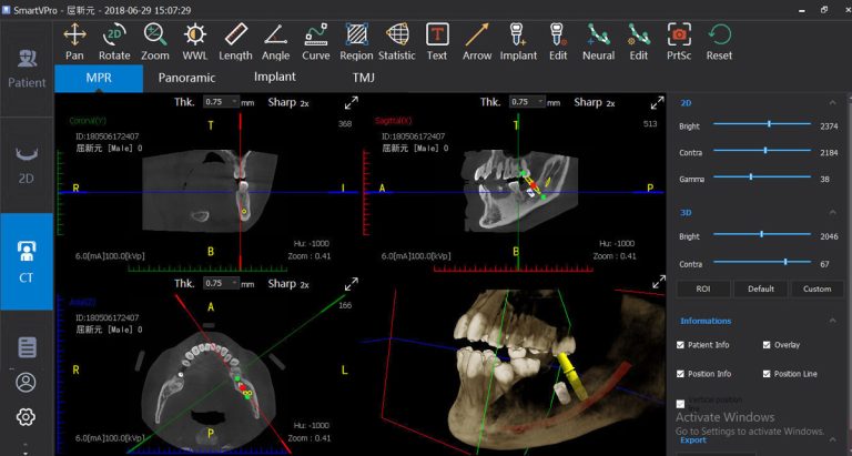 SmartVPro Dental Radiology Management Software | Gramm Dental Store