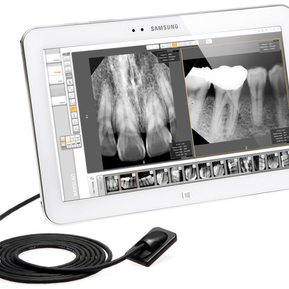 RIOSensor Intraoral Imaging Sensor | Gramm Dental